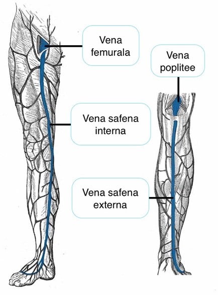 Chirurgia laser a varicelor - Dr. Serban Vasile